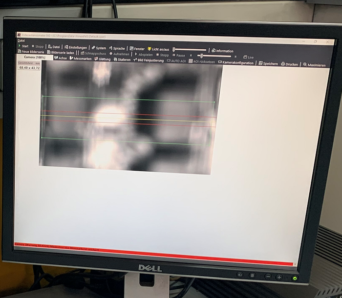 Axiální videoextensometr